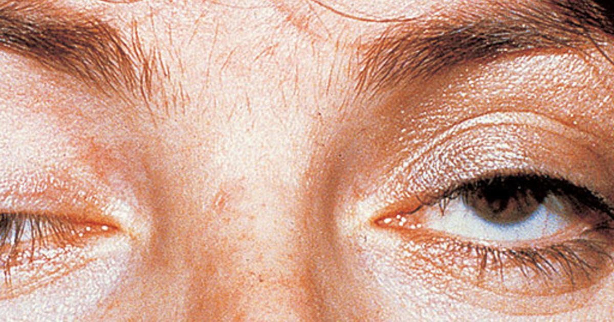 What do the eyes appear like when you die? - Business And News