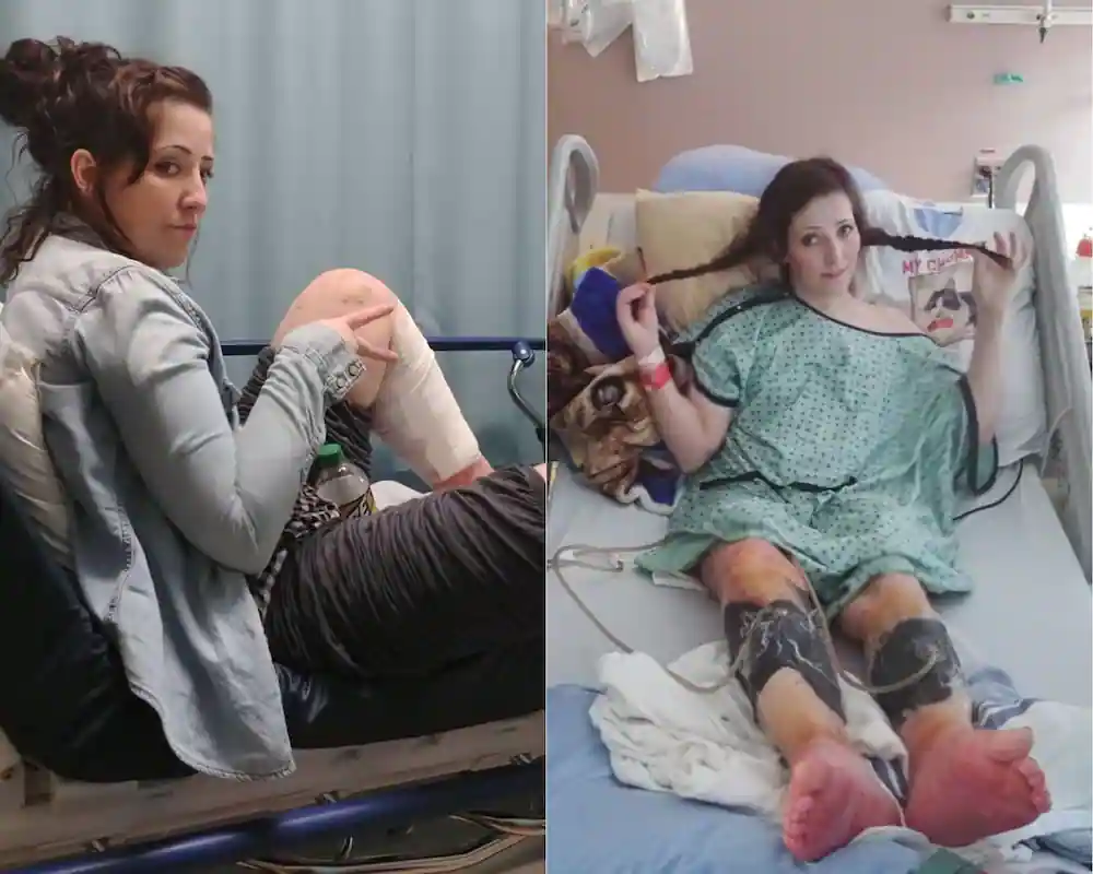 Kelly Ronahan: Amputation and her Full Story Described - Business And News